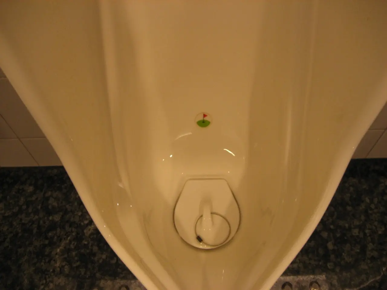 Distinguishing between Overactive Bladder and Urge Incontinence: Key ...